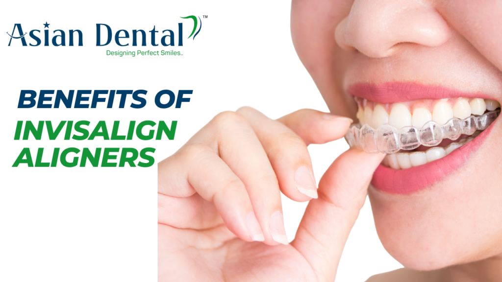Asian Dental Vijayawada: Benefits of Invisalign Aligners over ...